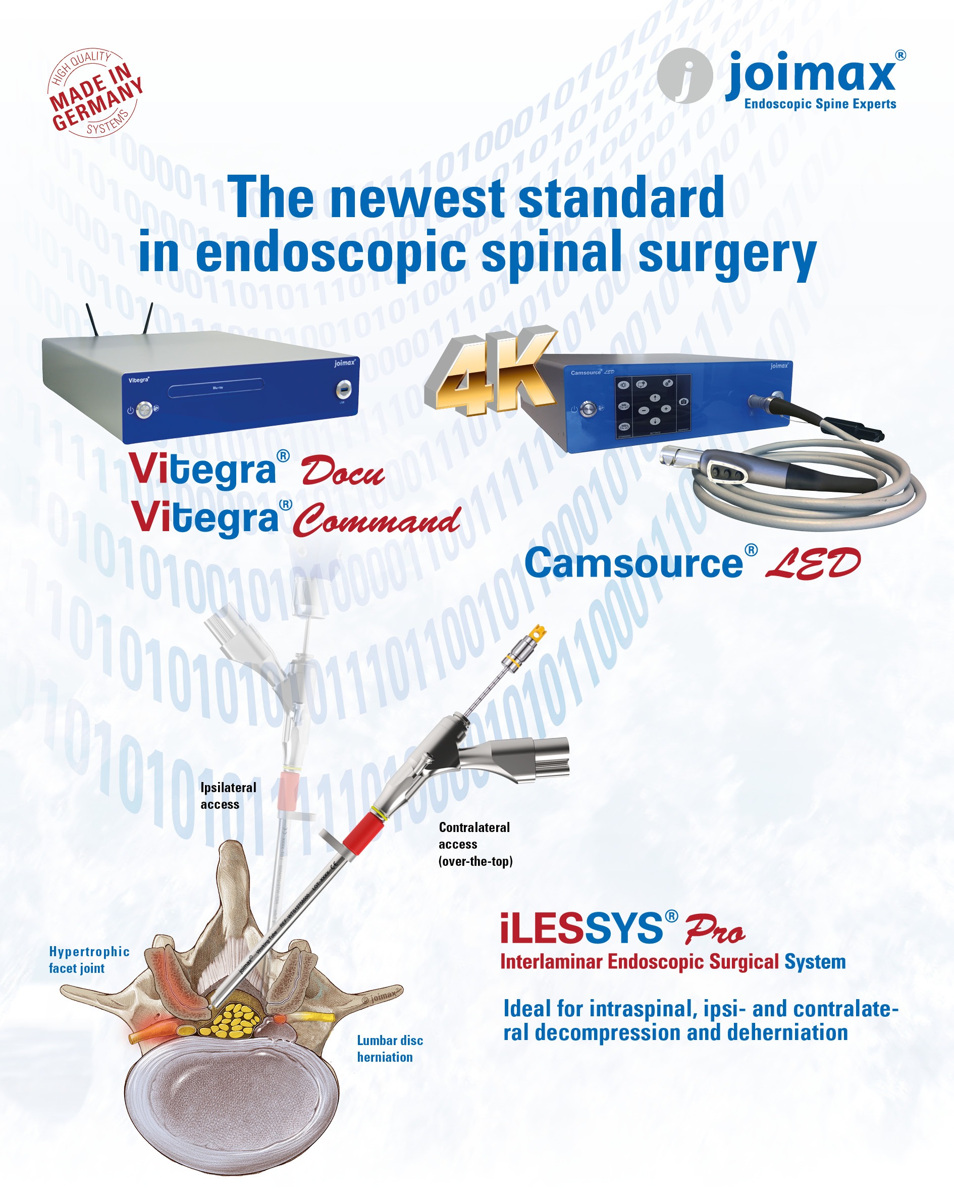 joimax® Launches Its Latest Interlaminar Endoscopic System, iLESSYS ...