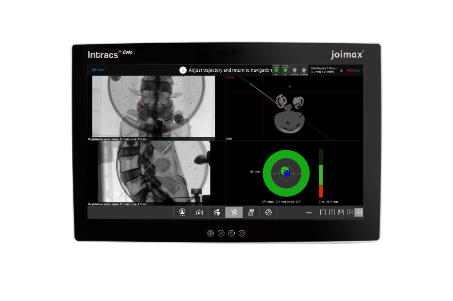 Intracs®em - The Smart Navigation System