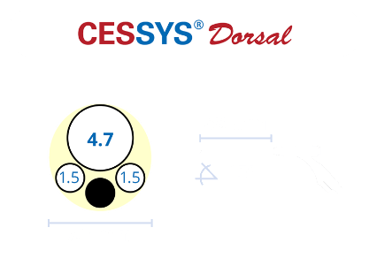 CESSYS® - joimax®