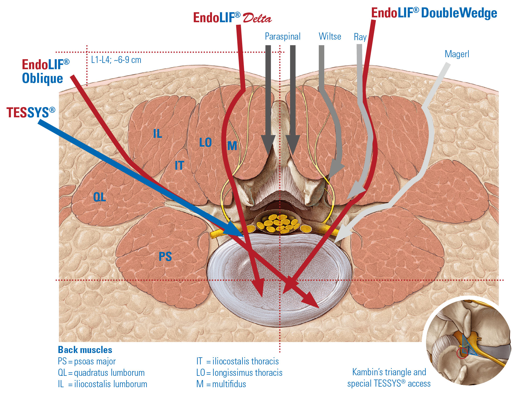 Stabilization - joimax®