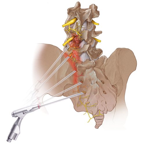 Pain Therapy - joimax®