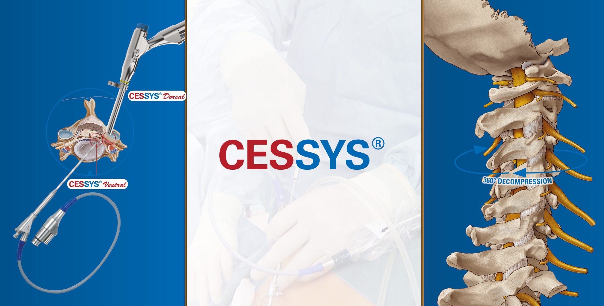 CESSYS® - joimax®